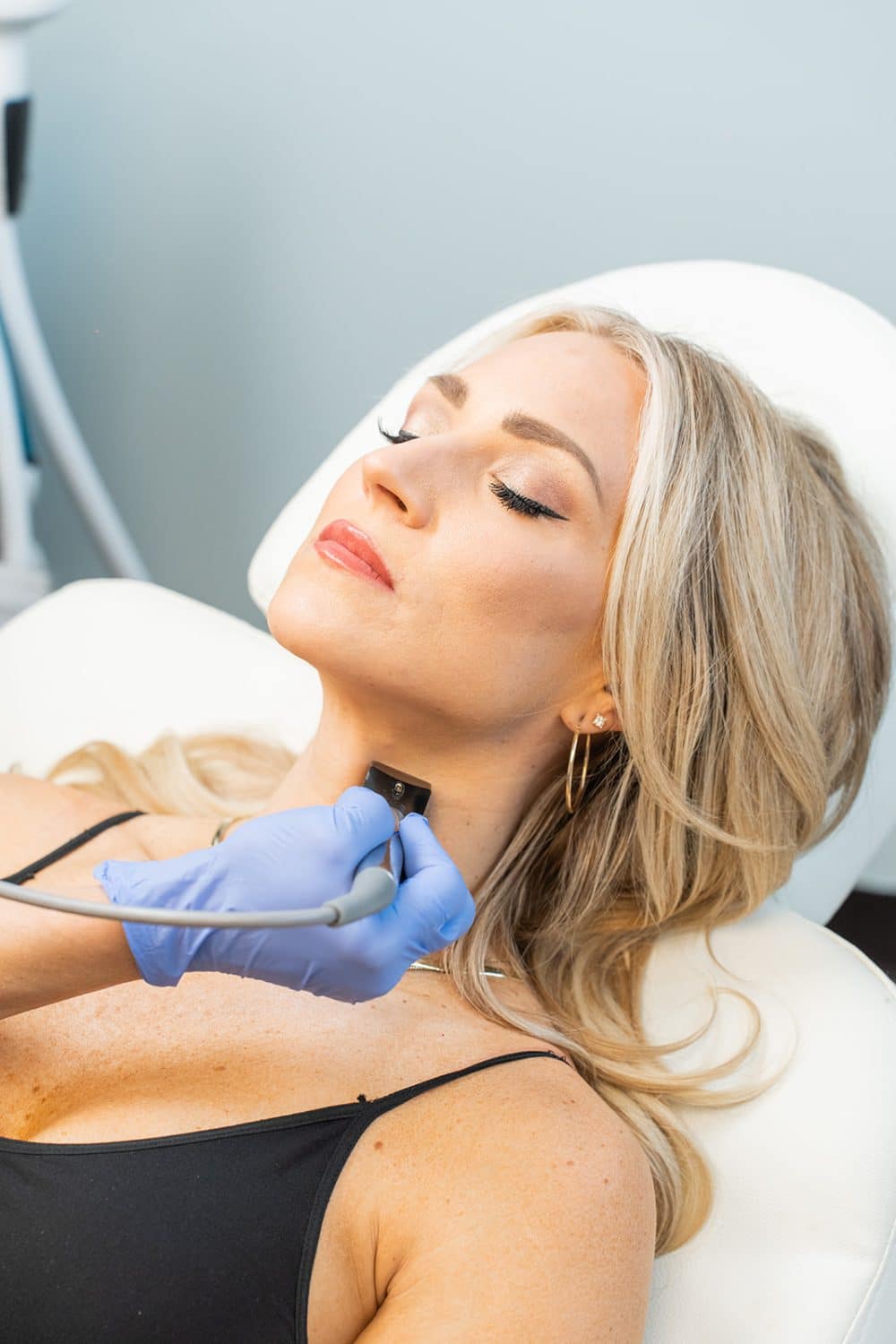 Forma Skin Tightening | Fort Mill, SC